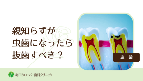 親知らずが虫歯になったら抜歯すべき？｜梅田クローバー歯科よくあるご質問